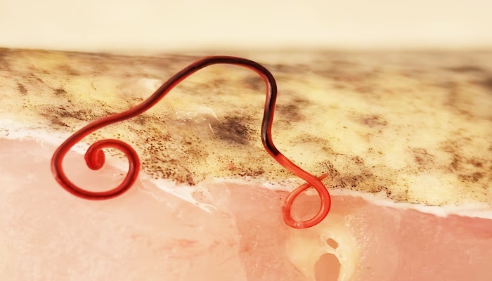 How to Effectively use a Parasite Cleansing Kit a Step by Step Guide ...